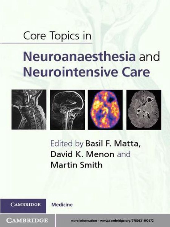 Core Topics in Neuroanaesthesia and Neurointensive Care (ebook) | 9781139152709 | Boeken | bol.com