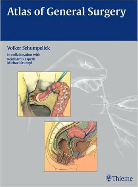 Atlas of General Surgery | 9783131440914 | Volker Schumpelick | Boeken | bol.com
