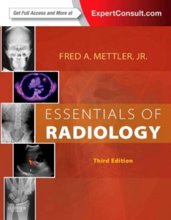 Essentials of Radiology | 9781455742257 | Fred Mettler | Boeken | bol.com