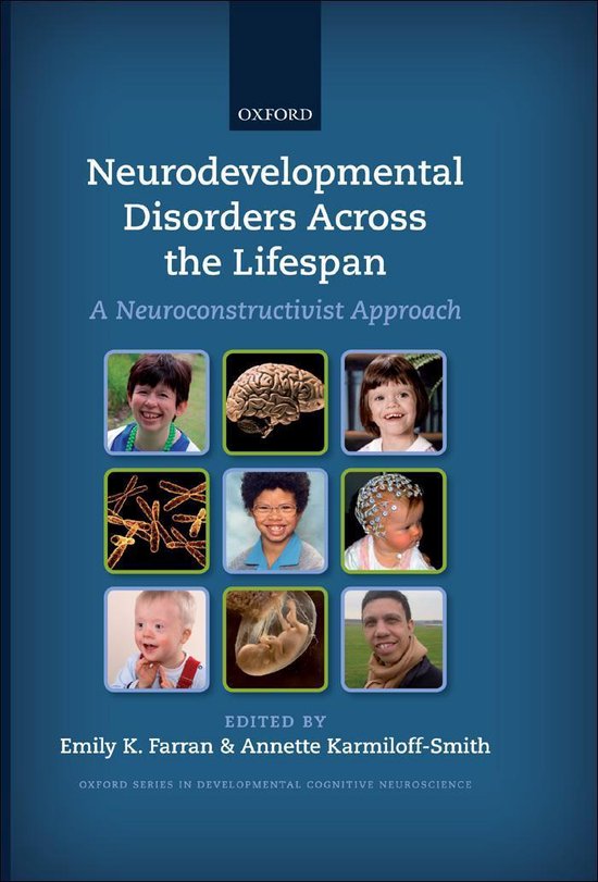 Developmental Cognitive Neuroscience - Neurodevelopmental Disorders ...