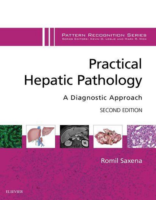Pattern Recognition - Practical Hepatic Pathology: A Diagnostic ...