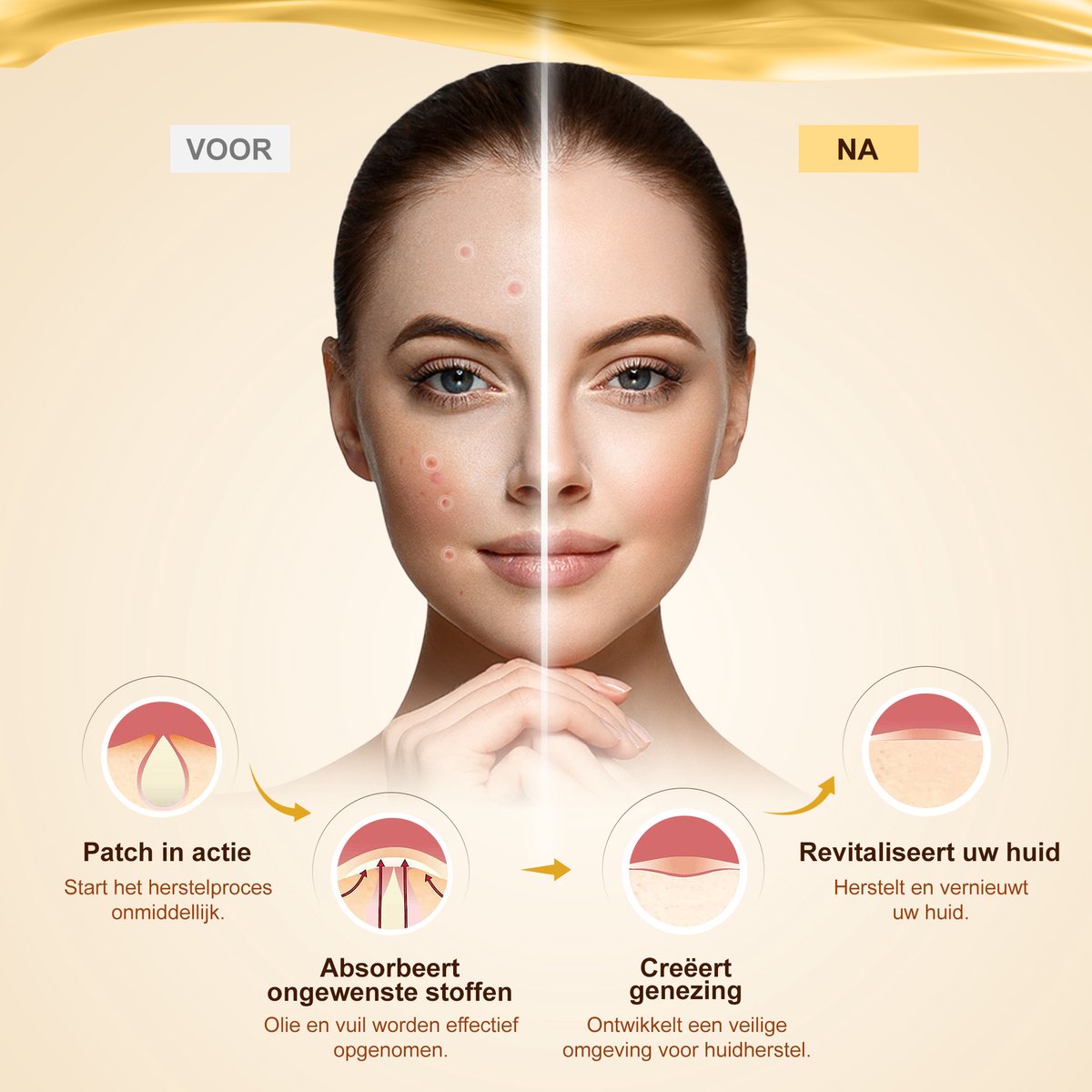 Dermaé Pimple patch - Verwijdert, Puistjes, Acne en Mee-eters ...