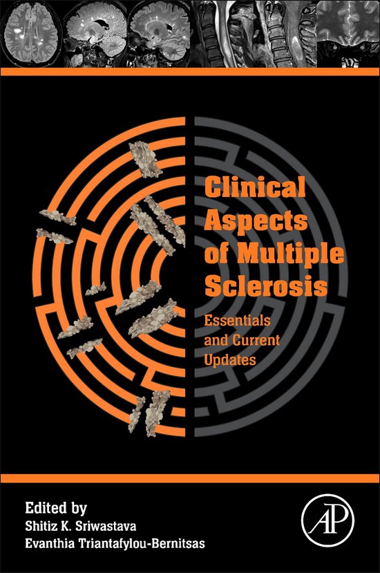 Clinical Aspects of Multiple Sclerosis Essentials and Current Updates ...
