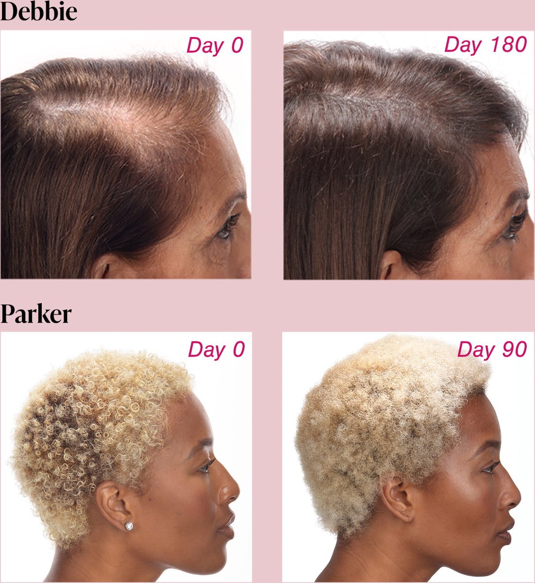 Viviscal - Hair Growth Supplements - Dietary Hair Supplement Tablets ...