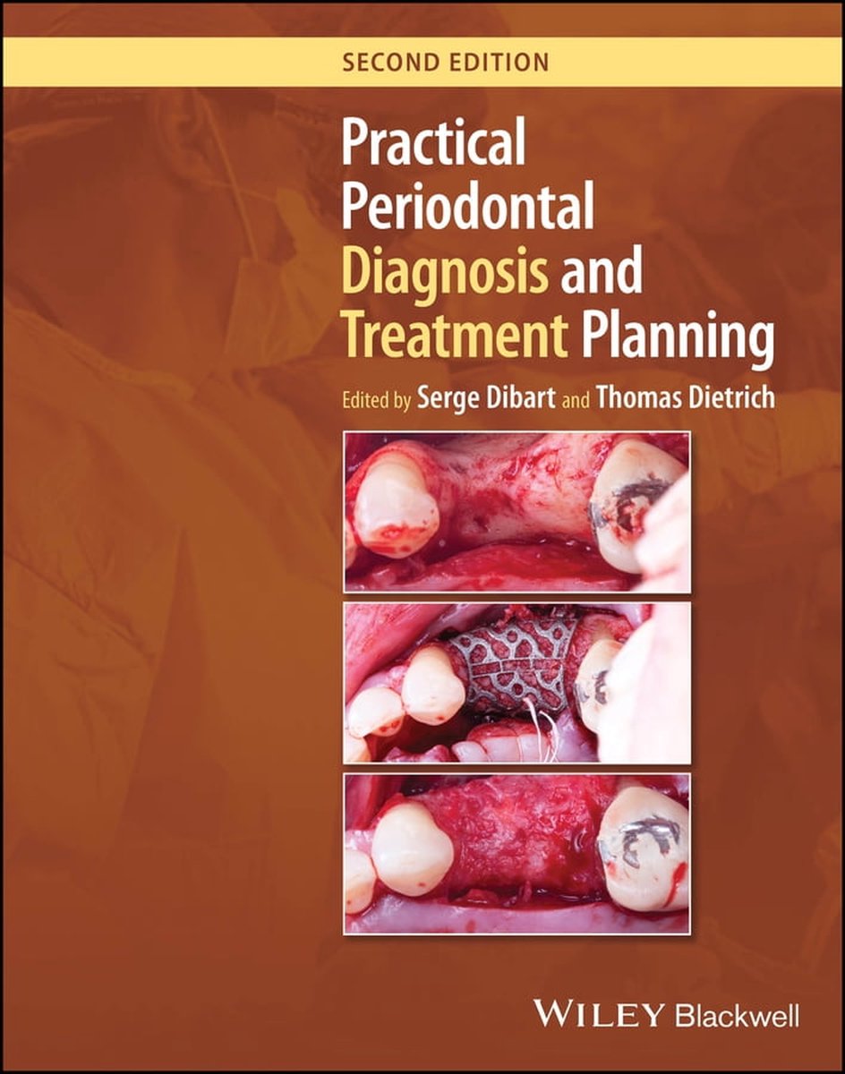 Practical Periodontal Diagnosis and Treatment Planning (ebook ...