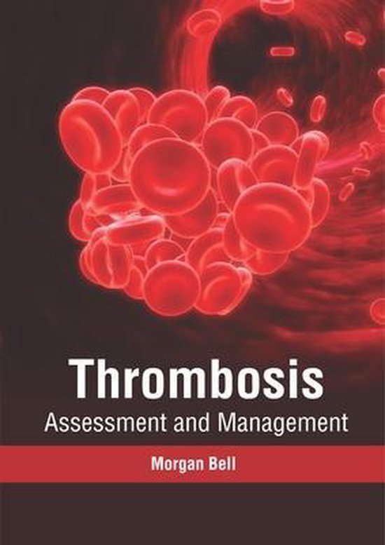 Thrombosis: Assessment and Management | 9781632416315 | Boeken | bol