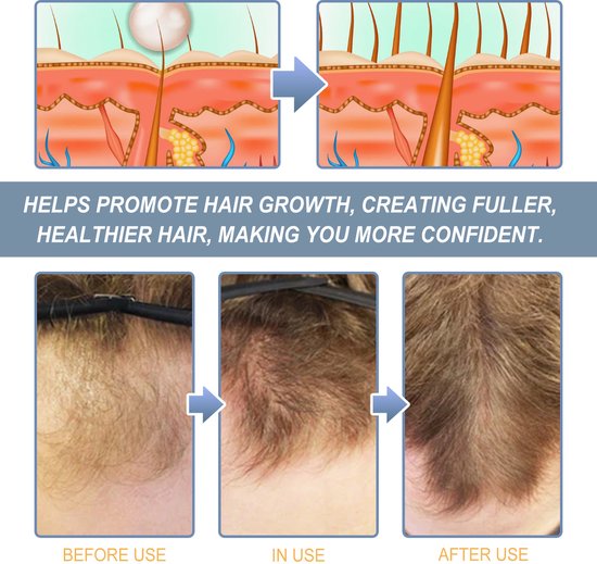 3ps Deze verzorgende haarscrub reinigt de hoofdhuid tegen roos, maakt ...