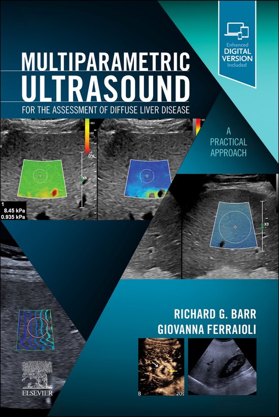 Multiparametric Ultrasound for the Assessment of Diffuse Liver Disease ...