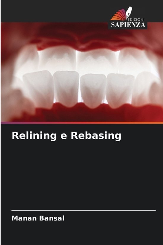 Relining e Rebasing, Manan Bansal | 9786208688523 | Boeken | bol