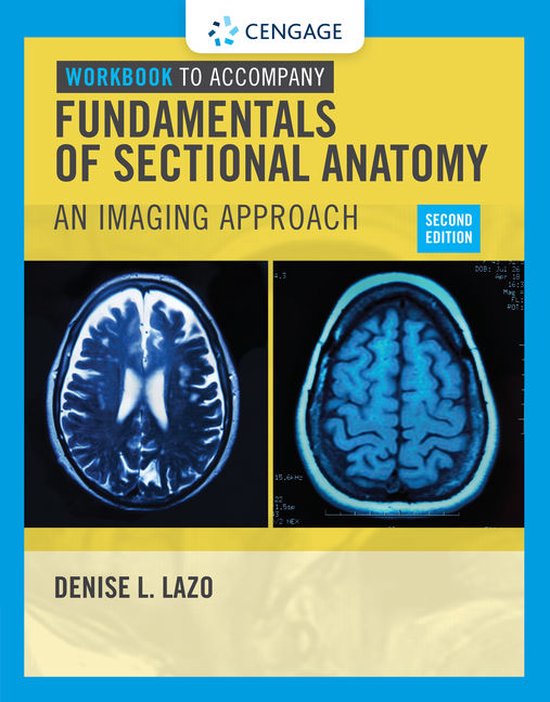Fundamentals of Sectional Anatomy | 9781133960850 | Irene Motyl ...