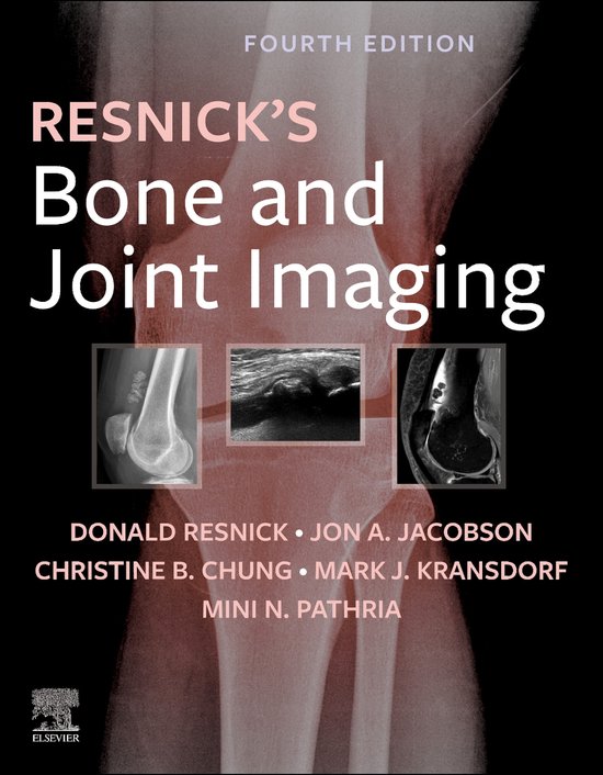 Bone and Joint Imaging (ebook), Jon A. Jacobson, Md | 9780323551588 ...