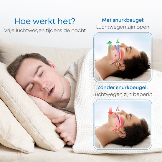 Alyze Anti Snurkbeugel - Verstelbaar bitje tegen snurken en ...