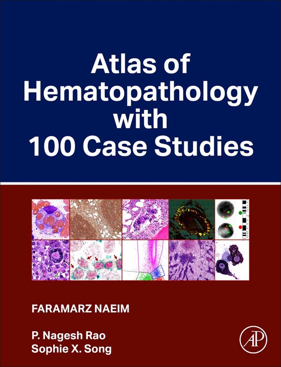 Atlas of Hematopathology with 100 Case Studies (ebook), P. Nagesh Rao | 9780443188398... | bol