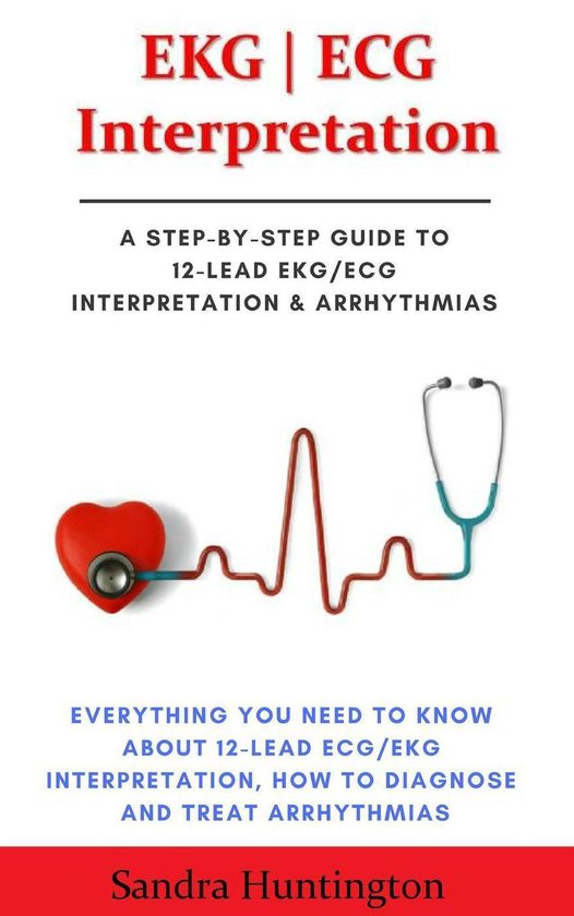 EKG ECG Interpretation. Everything You Need to Know about 12-Lead ECG/EKG... | bol