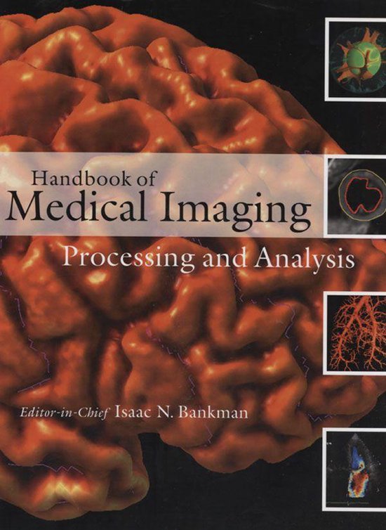 Handbook of Medical Imaging (ebook), John Semmlow | 9780080533100 ...