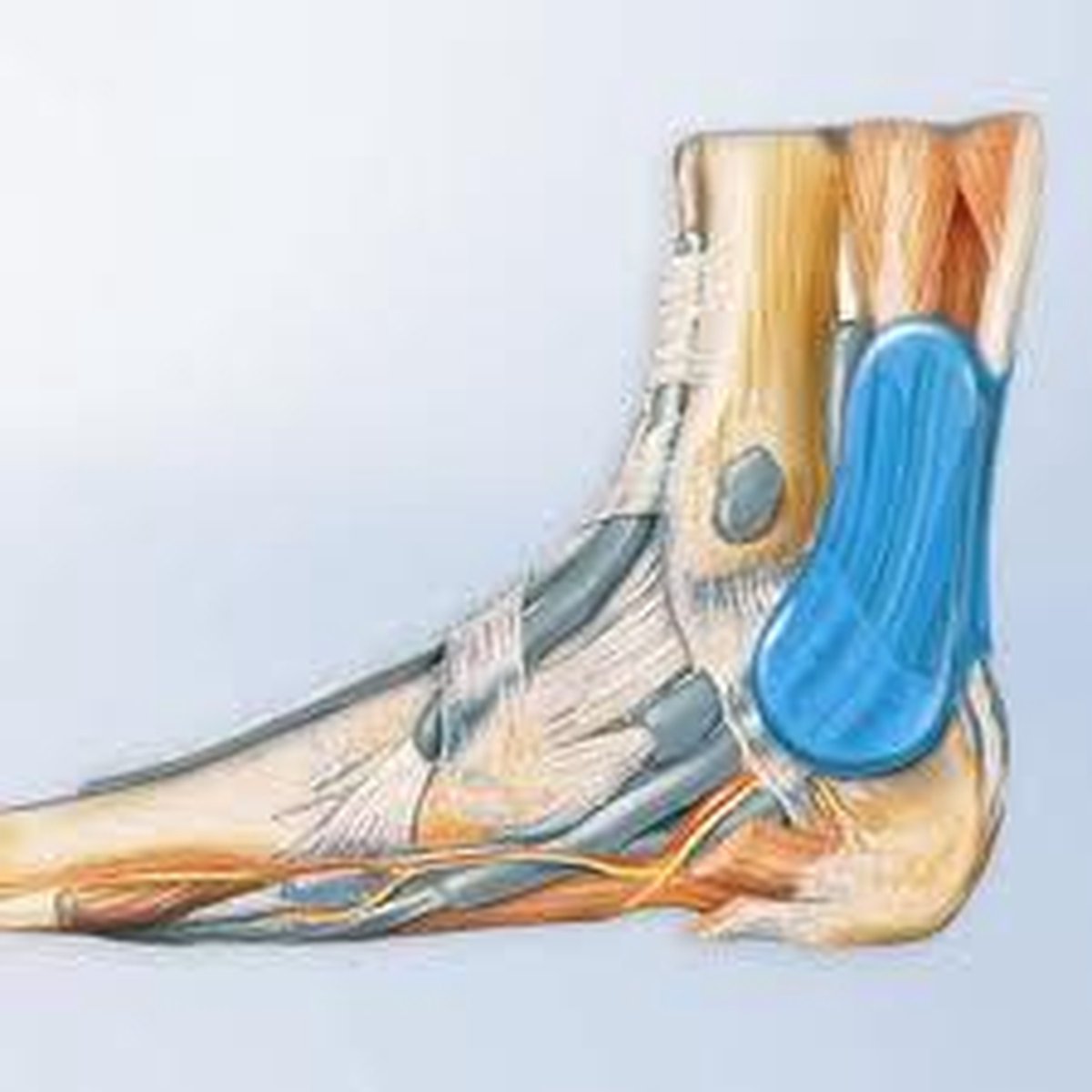 Novamed Morsa Achiloberg Achillespees Brace - Elastisch - Links | bol.com