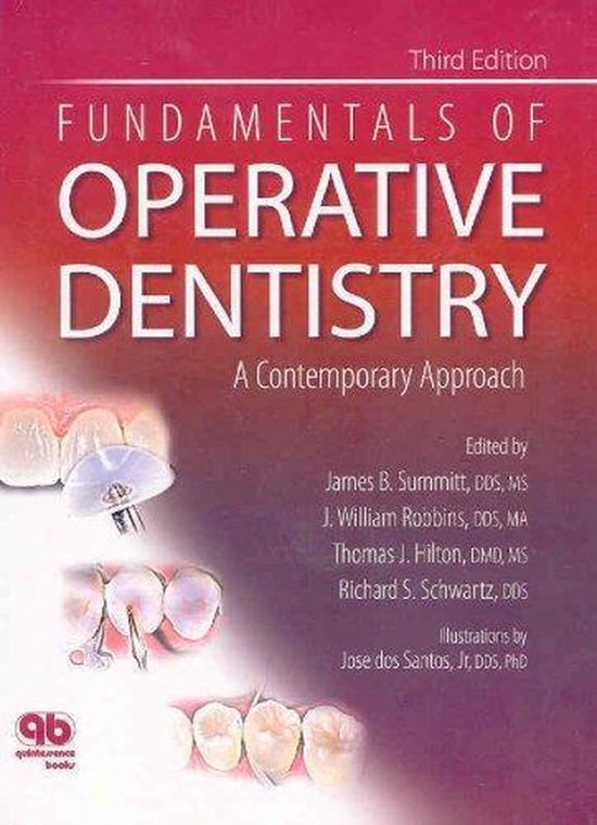 Fundamentals of Operative Dentistry | 9780867154528 | James B. Summit ...