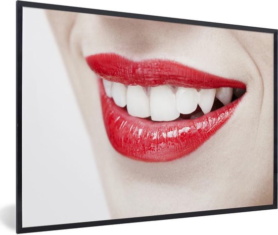 Fotolijst incl. Poster - Een afbeelding van rode lippen met witte ...