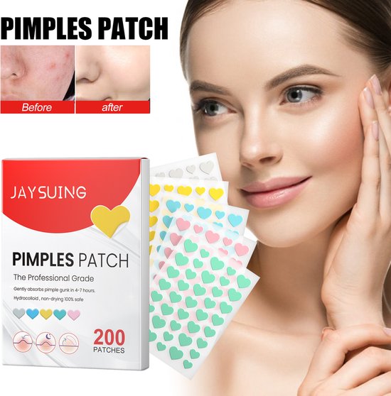 Liefde acne patch mild en niet-irriterend om acne vlekken en acne markeringen te... | bol