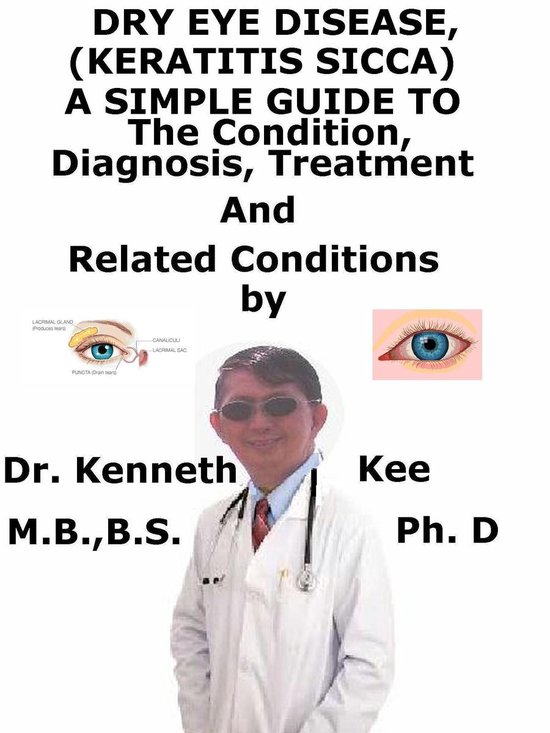 Dry Eye Disease, (Keratitis Sicca) A Simple Guide To The Condition ...