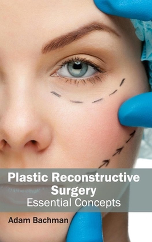 Plastic Reconstructive Surgery | 9781632423245 | Boeken | bol.com