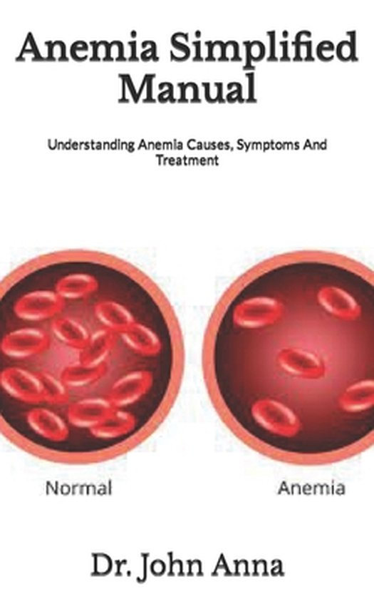 Anemia Simplified Manual, Dr John Anna | 9798498585536 | Boeken | bol.com