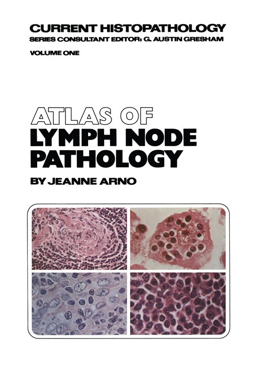 Current Histopathology- Atlas of Lymph Node Pathology | 9789401166386 ...