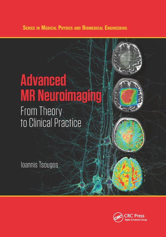 Series in Medical Physics and Biomedical Engineering- Advanced MR ...