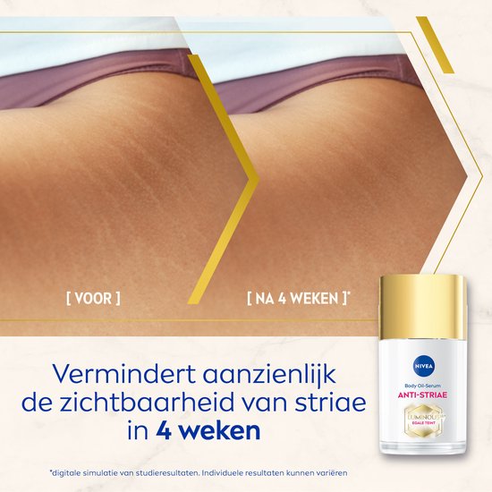 NIVEA Luminous630 Anti-Striae Body Olie Serum - Tegen striemen - 100ml ...