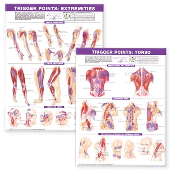 Trigger Point Laminated Chart Set: Torso & Extremities Second edition ...