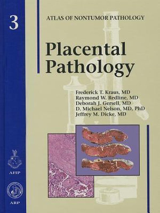 Atlas of Non-Tumor Pathology, Series 1,- Placental Pathology | 9781881041894 | Raymond... | bol