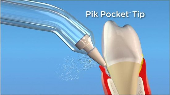 bol.com | Waterpik PP-100 Pik-Pocket Tips - Opzetstukken Voor ...