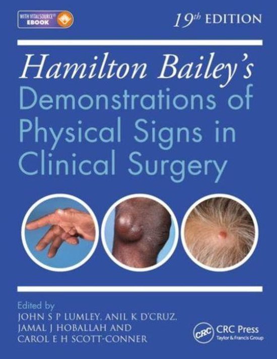 Hamilton Baileys Physical Signs | 9781444169188 | John S. P. Lumley ...