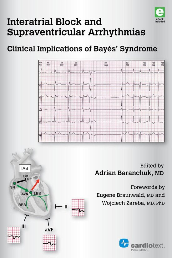Interatrial Block and Supraventricular Arrhythmias: Clinical ...