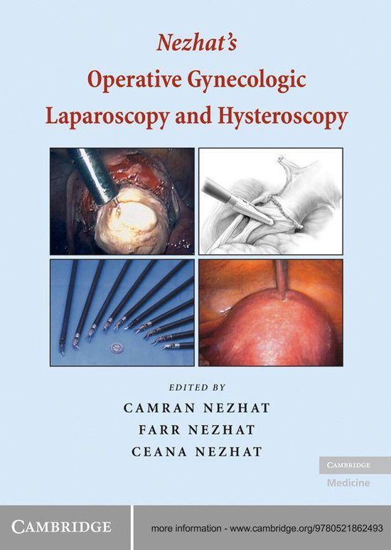Nezhat's Operative Gynecologic Laparoscopy and Hysteroscopy (ebook ...
