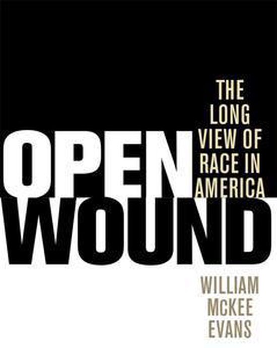 Open Wound (ebook), William Mckee Evans | 9780252091148 | Boeken | bol.com