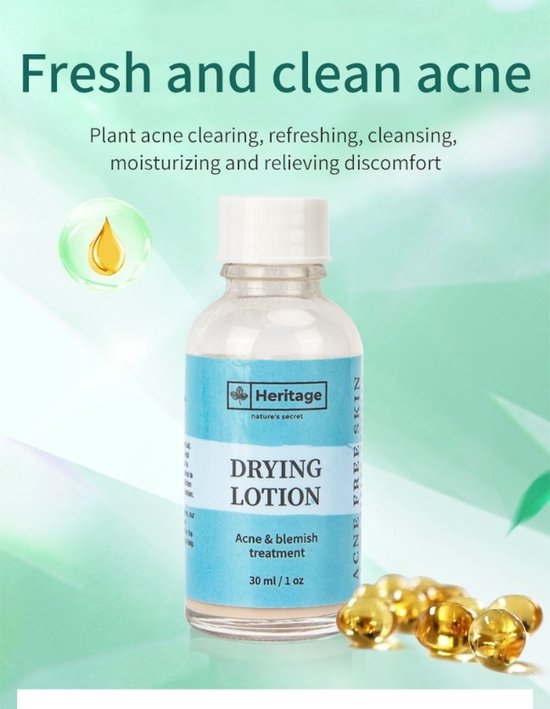 Acne drying lotion voor acnesvlekken, onstekingen, acne en litteken ...