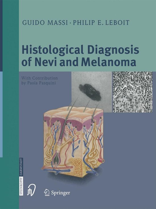 Histological Diagnosis of Nevi and Melanoma (ebook), Philip E. LeBoit ...