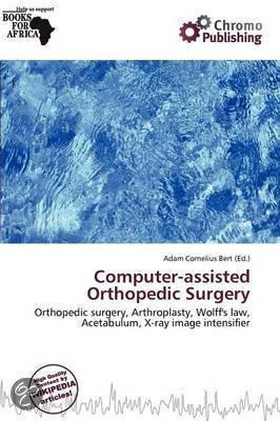 Computer-Assisted Orthopedic Surgery | 9786139819829 | Boeken | bol