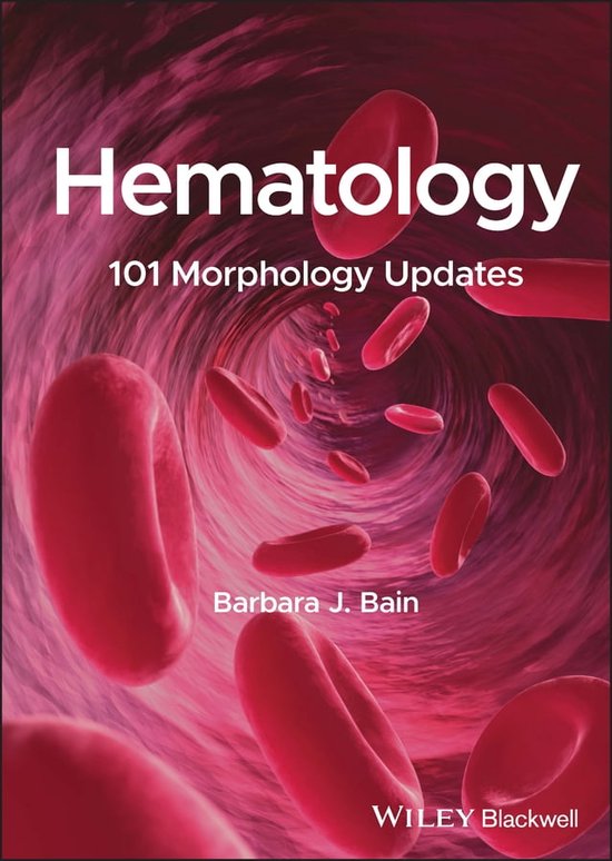 Hematology (ebook), Barbara J. Bain | 9781394179770 | Boeken | bol