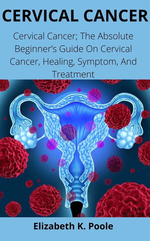 CERVICAL CANCER (ebook), Elizabeth K. Poole | 1230006293963 | Boeken | bol
