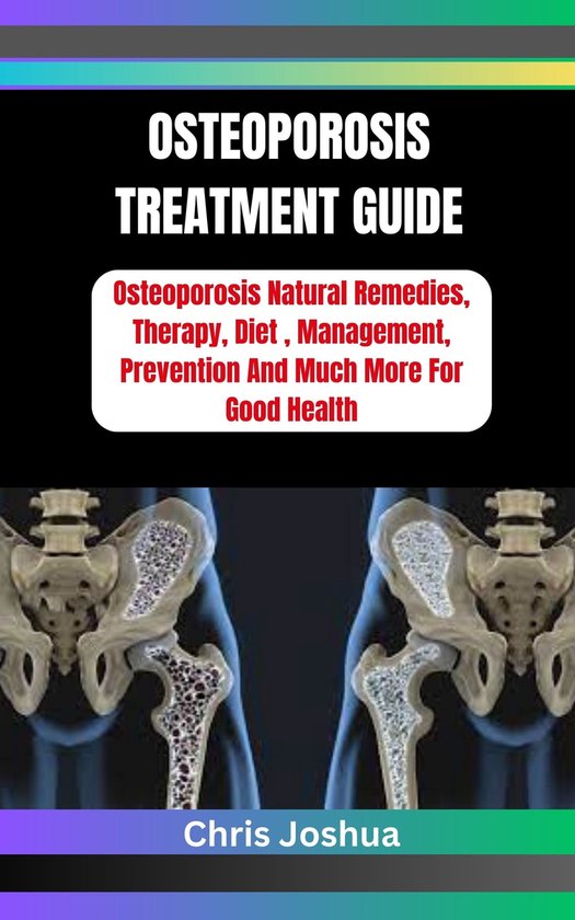 OSTEOPOROSIS TREATMENT GUIDE (ebook), Chris Joshua | 1230006414276 ...