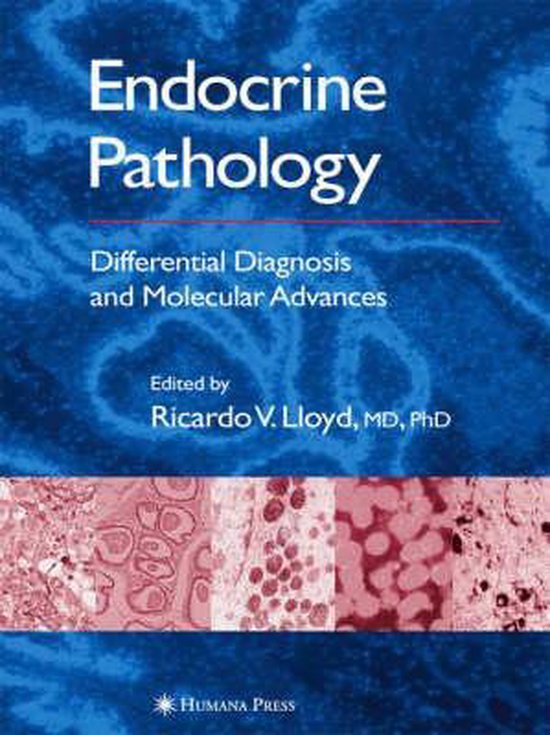 Endocrine Pathology | 9781588292087 | Ricardo V. Lloyd | Boeken | bol