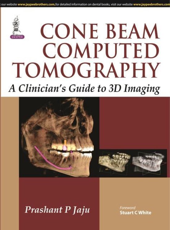 Cone Beam Computed Tomography | 9789351526391 | Prashant P Jaju | Boeken | bol.com