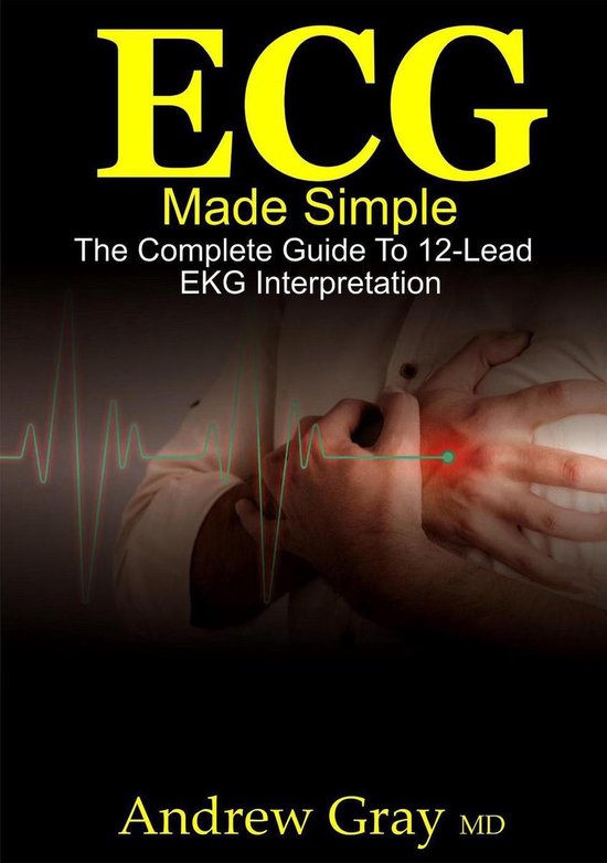 ECG Made Simple (ebook), Andrew Gray Md | 9781393559610 | Boeken | bol.com
