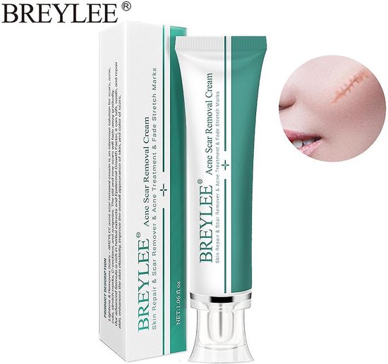 Litteken En Striae Verwijderen Huidcrème Acne Litteken Behandeling Voor... | bol