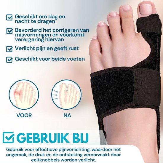 U Fit One 2 Stuks Hallux Valgus Bunion Grote Teen Spalk - Verstelbaar ...