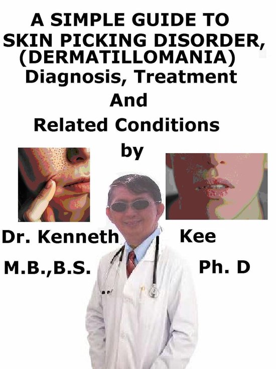 A Simple Guide to Skin Picking Disorder, (Dermatillomania) Diagnosis ...