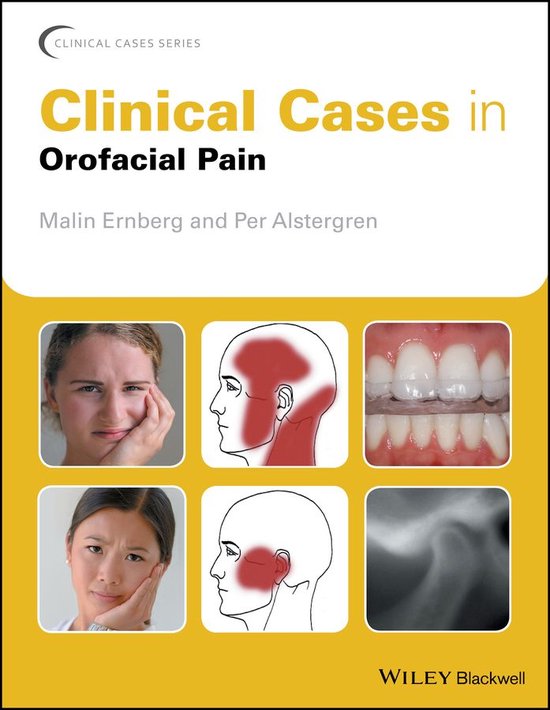 Clinical Cases (Dentistry) - Clinical Cases in Orofacial Pain (ebook ...