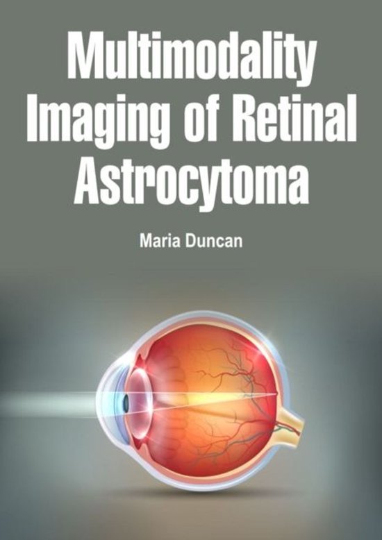 Multimodality Imaging of Retinal Astrocytoma (ebook), Maria Duncan ...